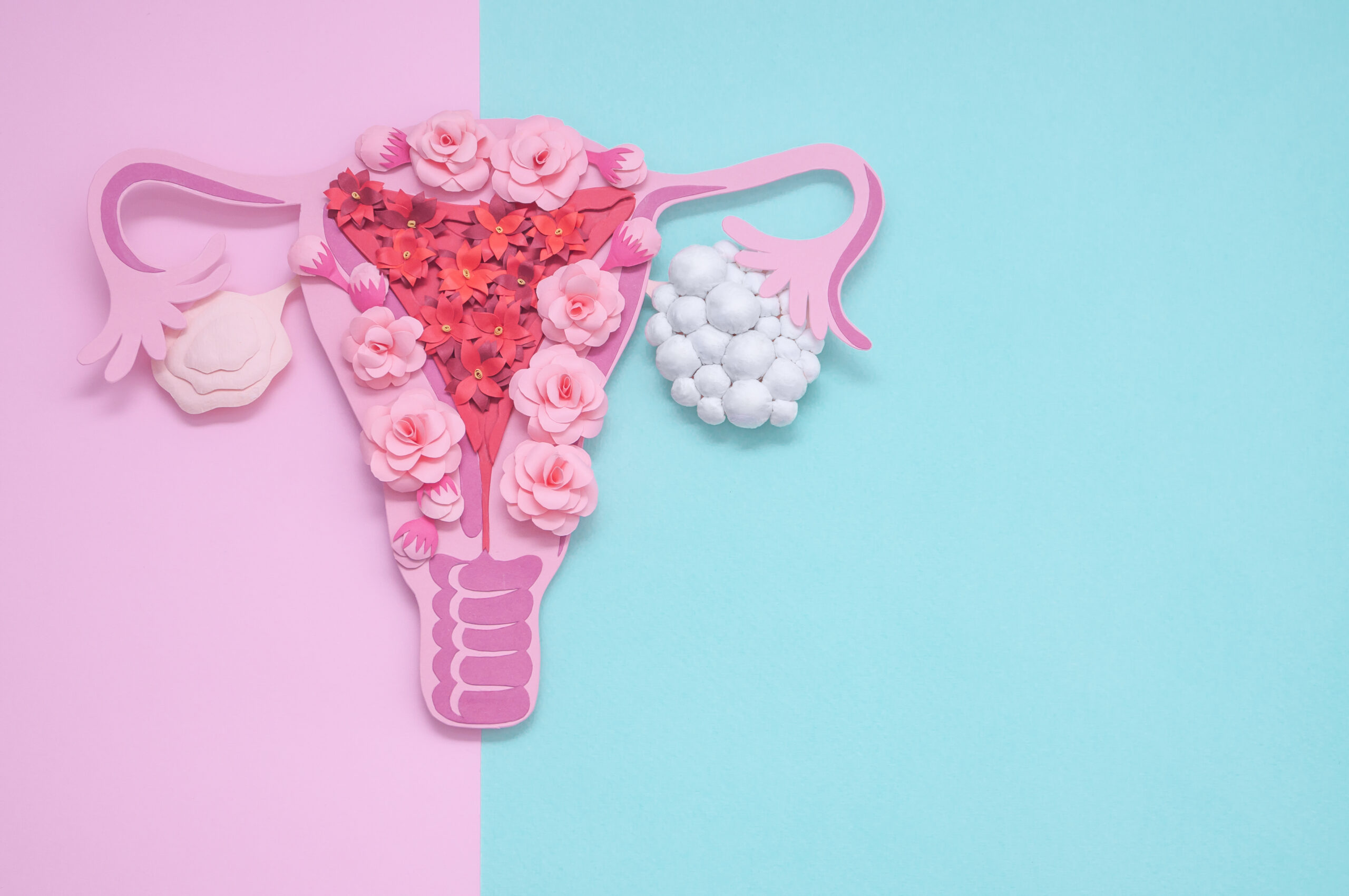 Understanding PCOS: Symptoms, Causes, and Management • Merrion ...