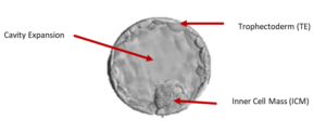 Understanding Embryo Grading • Merrion Fertility Clinic